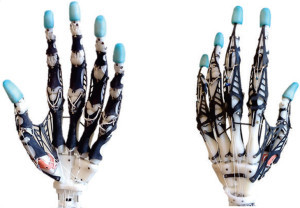 New Robotic Prosthetic Hand Replicates the Real Deal | American Health ...
